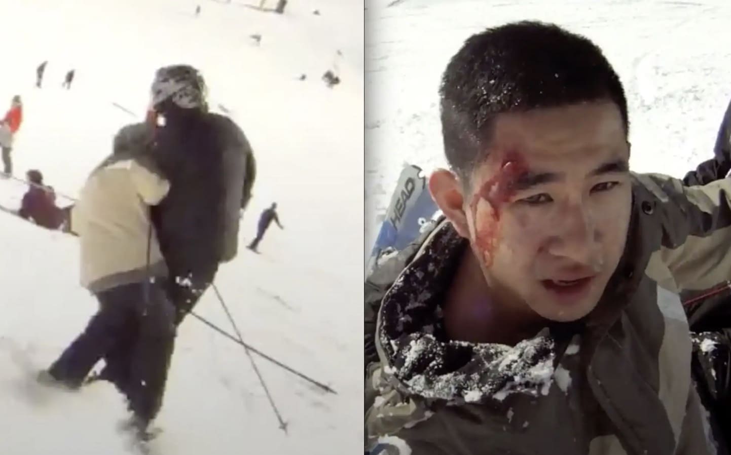 Out of Control Skier Bloodied After Causing Collision - Unofficial Networks