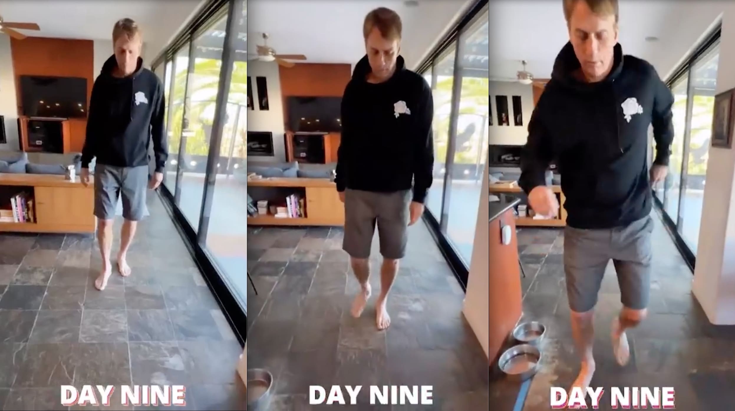 Tony Hawk Walks Without Crutches 9 Day After Breaking Femur